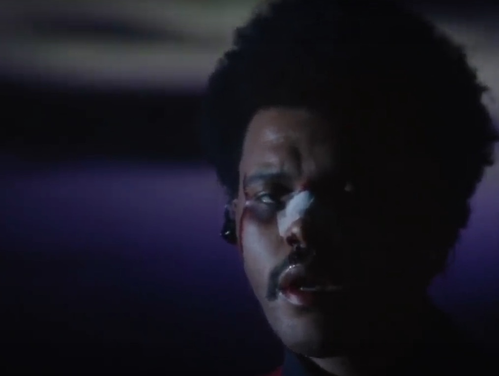 Watch The Weeknd's Bloody, Theatrical Kimmel Performance